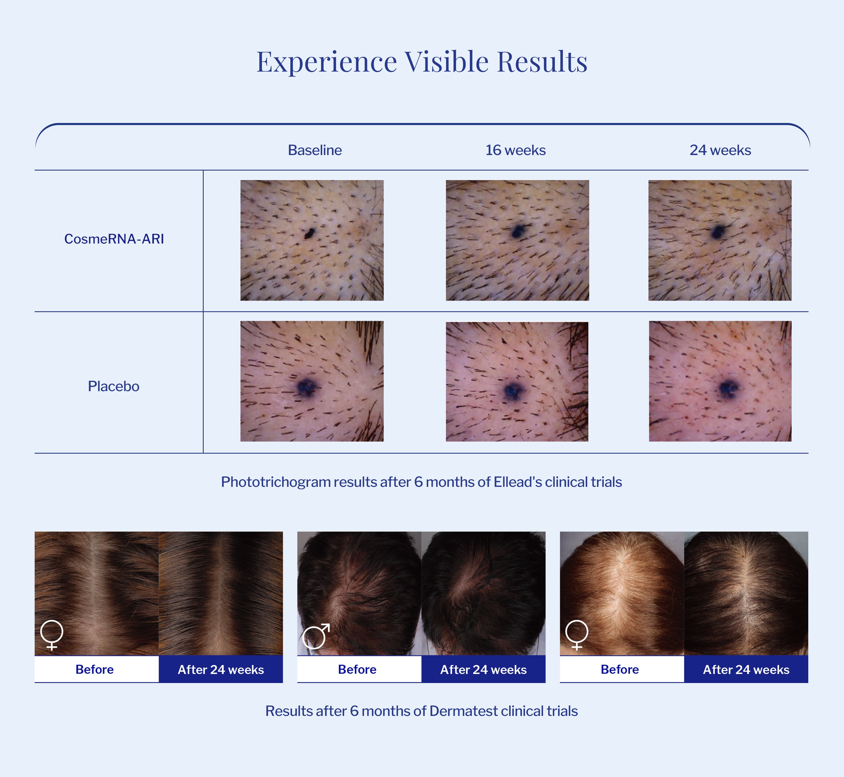 Cosmerna – CosmeRNA