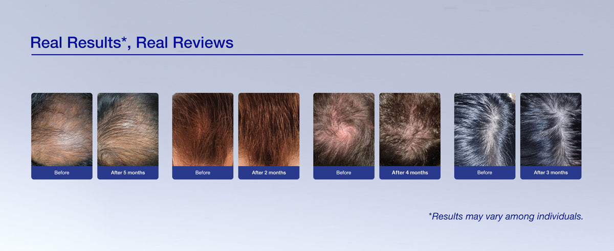 CosmeRNA™; Anti-Hair Loss RNA Tonic (6mL)