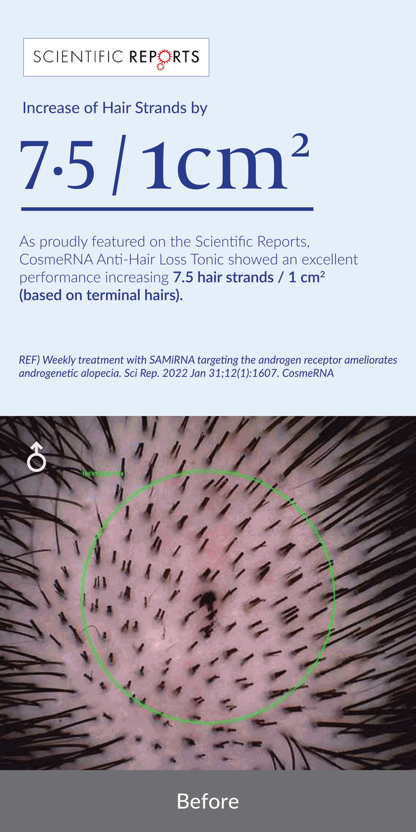 CosmeRNA Anti-hair Loss RNA Tonic (1ml*2EA)