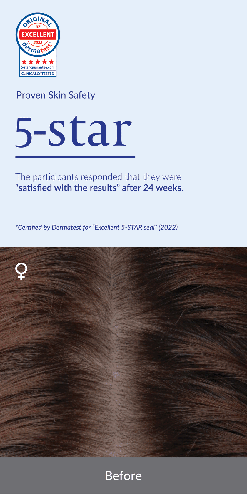 CosmeRNA Anti-hair Loss RNA Tonic (1ml*2EA)